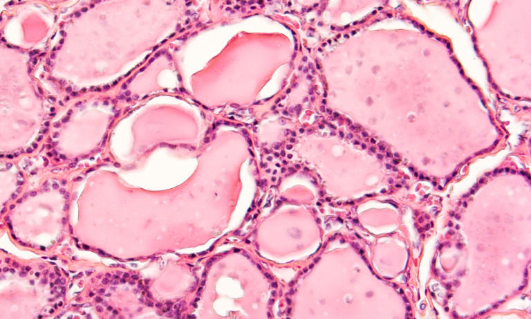 Extracellular Vesicles and Exosomes in Tissue Regeneration